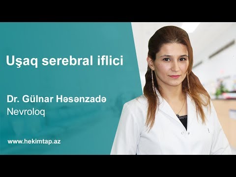 Uşaq serebral iflici - Nevroloq  Gülnar Həsənzadə