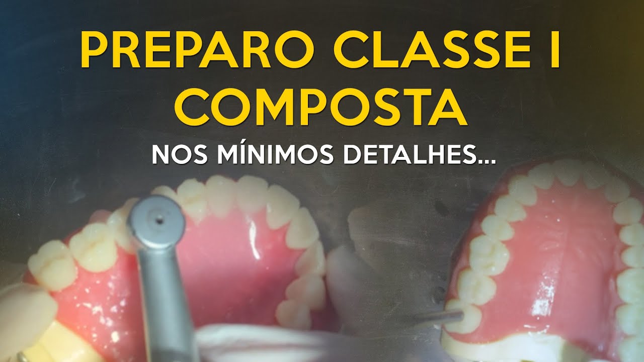 Preparo Classe I composta nos mínimos detalhes | DENTÍSTICA - YouTube