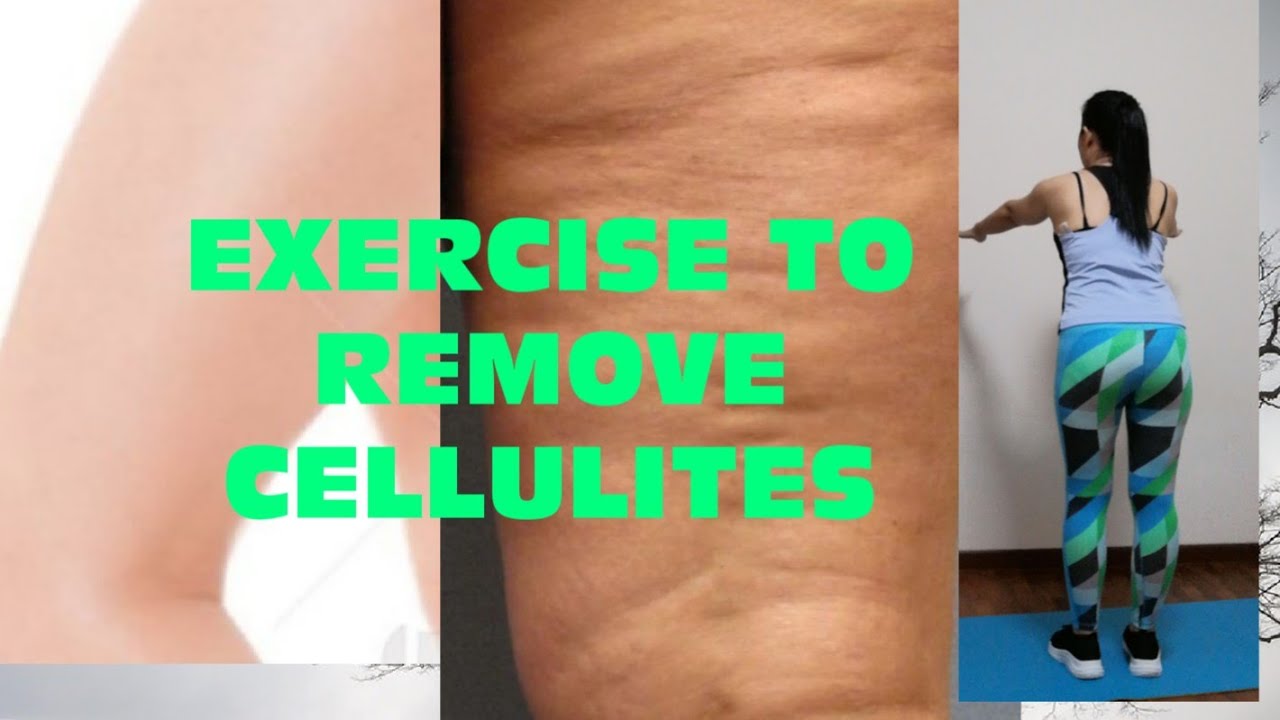 HOW TO GET RID OF CELLULITES Good shape and good health.. .Filipina.in ...