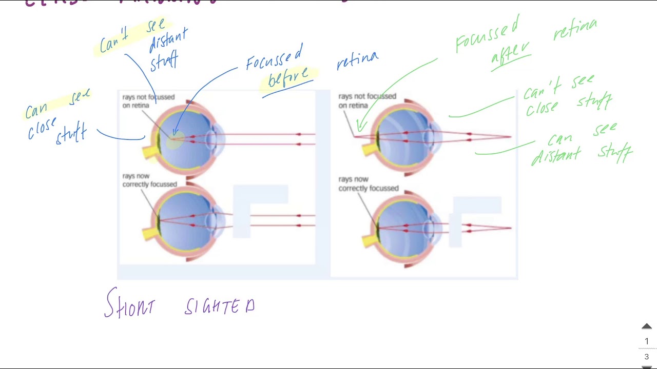 Long and short sightedness - YouTube