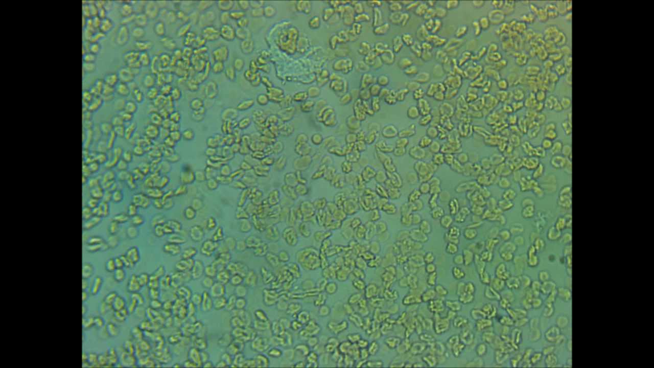 Red Blood Cells under microscope 400x - YouTube