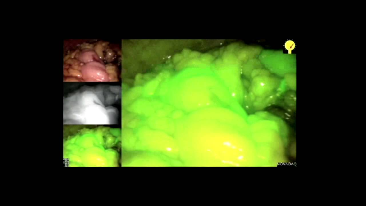 Real Time Intra-Operative Endoscopic Fluorescence Imaging for ...
