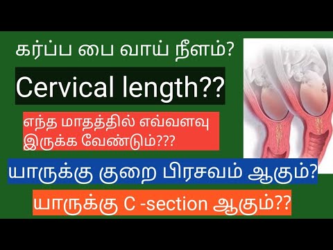 Cervical length? normal delivery? C-section? - YouTube