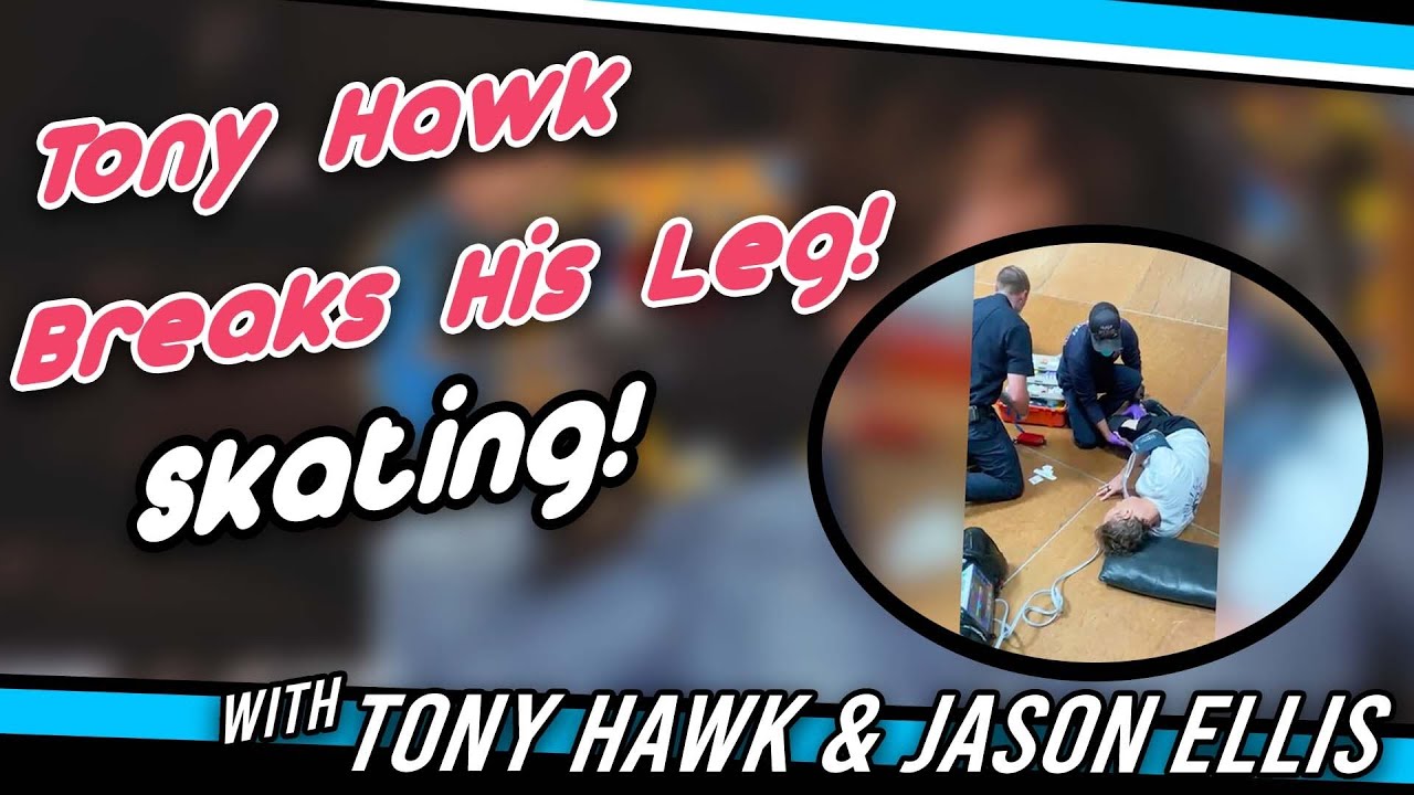 Tony Hawk Breaks his Leg! - YouTube