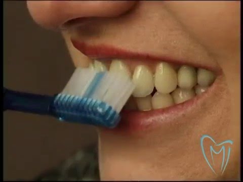 Técnica correcta de cepillado dental. - YouTube