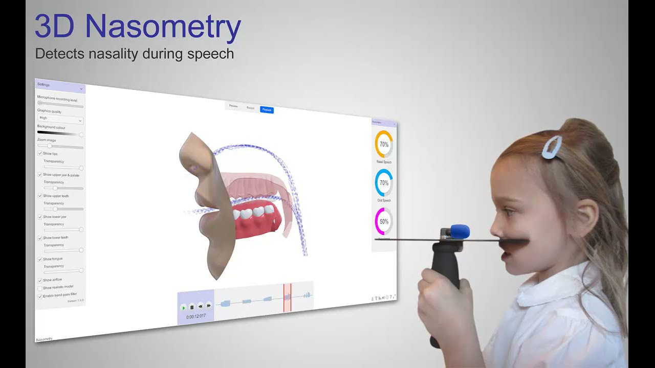 3D Nasometry - YouTube