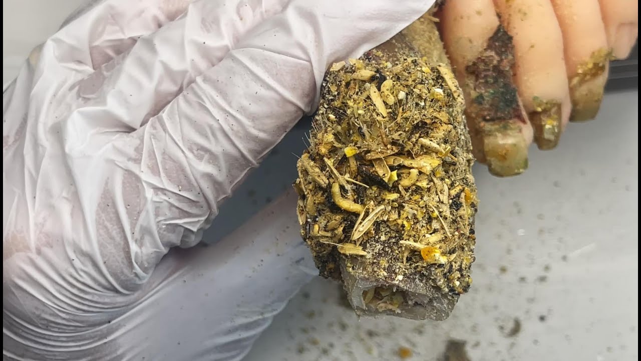 CUT Ingrown Toenails, Toenails with Maggots, Fungal Toenails ...