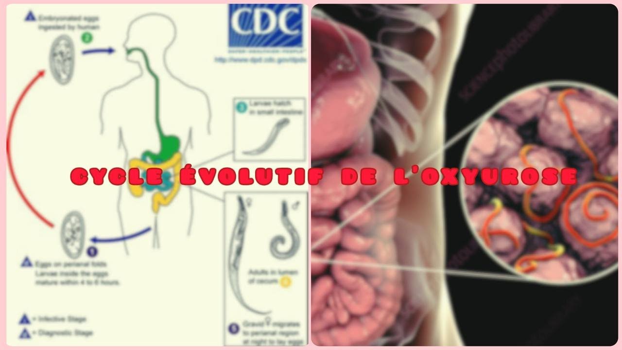 10 mins pour comprendre le CYCLE EVOLUTIF DE L'OXYUROSE - YouTube