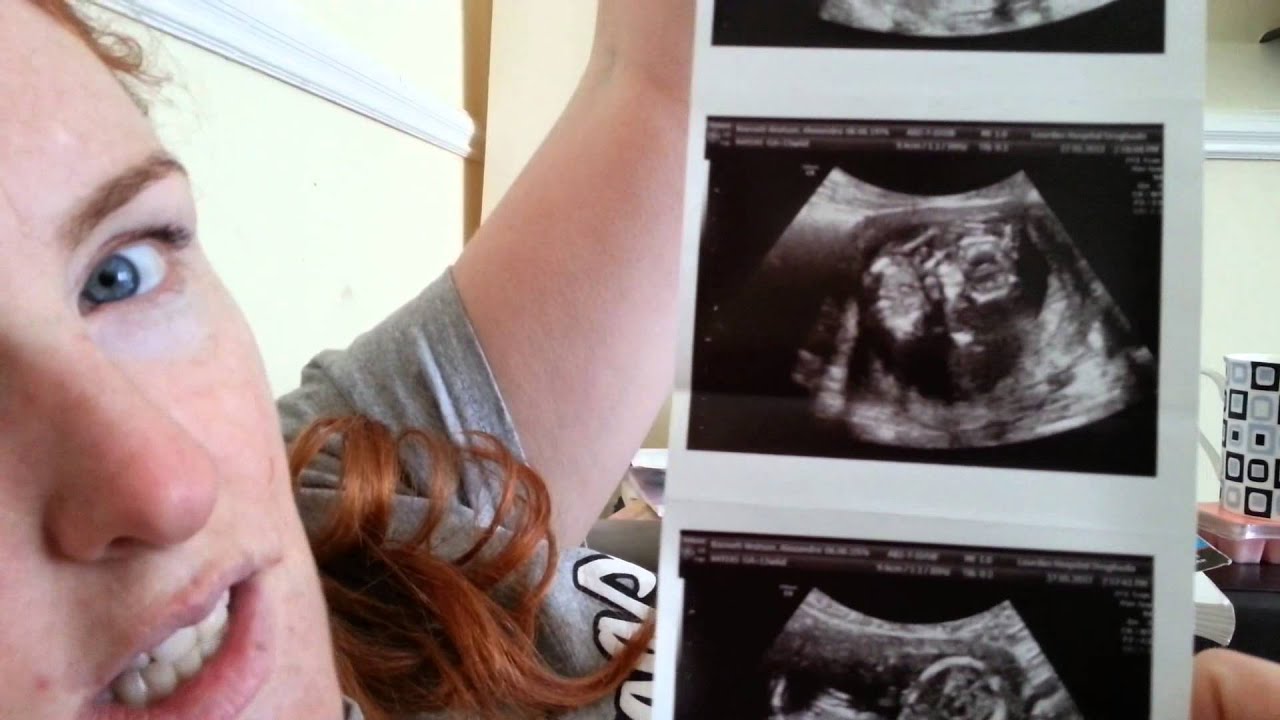 Im Pregnant - Baby Scan 14 Weeks - Vlog Two - YouTube