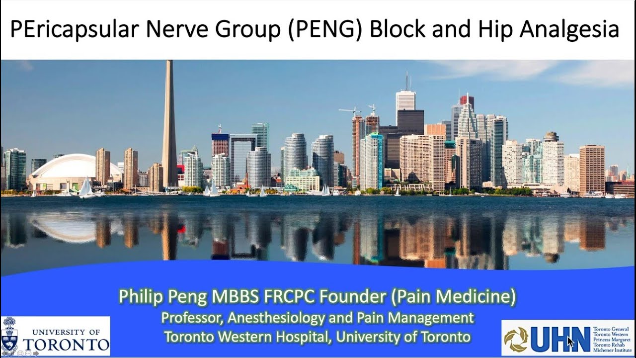 Innervation of the Hip Joint and PENG block for Hip Fracture and Hip ...