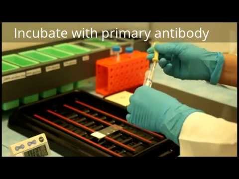 Immunohistochemistry - Procedure - YouTube