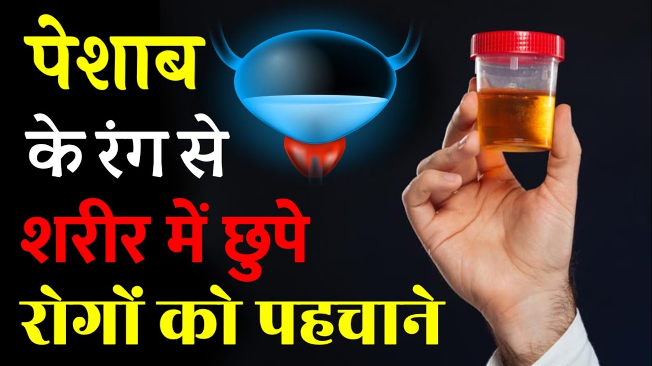 Peshab Ka Rang Kaisa Hona Chahiye| पेशाब का रंग कैसा होना चाहिए| # ...