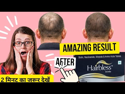 Hairbless Tablet: Solution for Hair Health | Healthy Pharma - YouTube