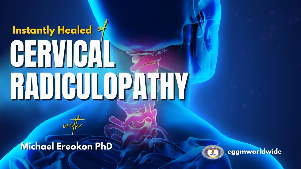 Instantly Healed of Cervical Radiculopathy (Pinched Nerve on The Neck ...