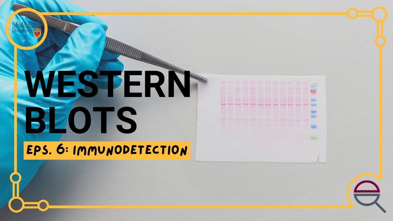 Western Blot: Introduction to Immunodetection - YouTube
