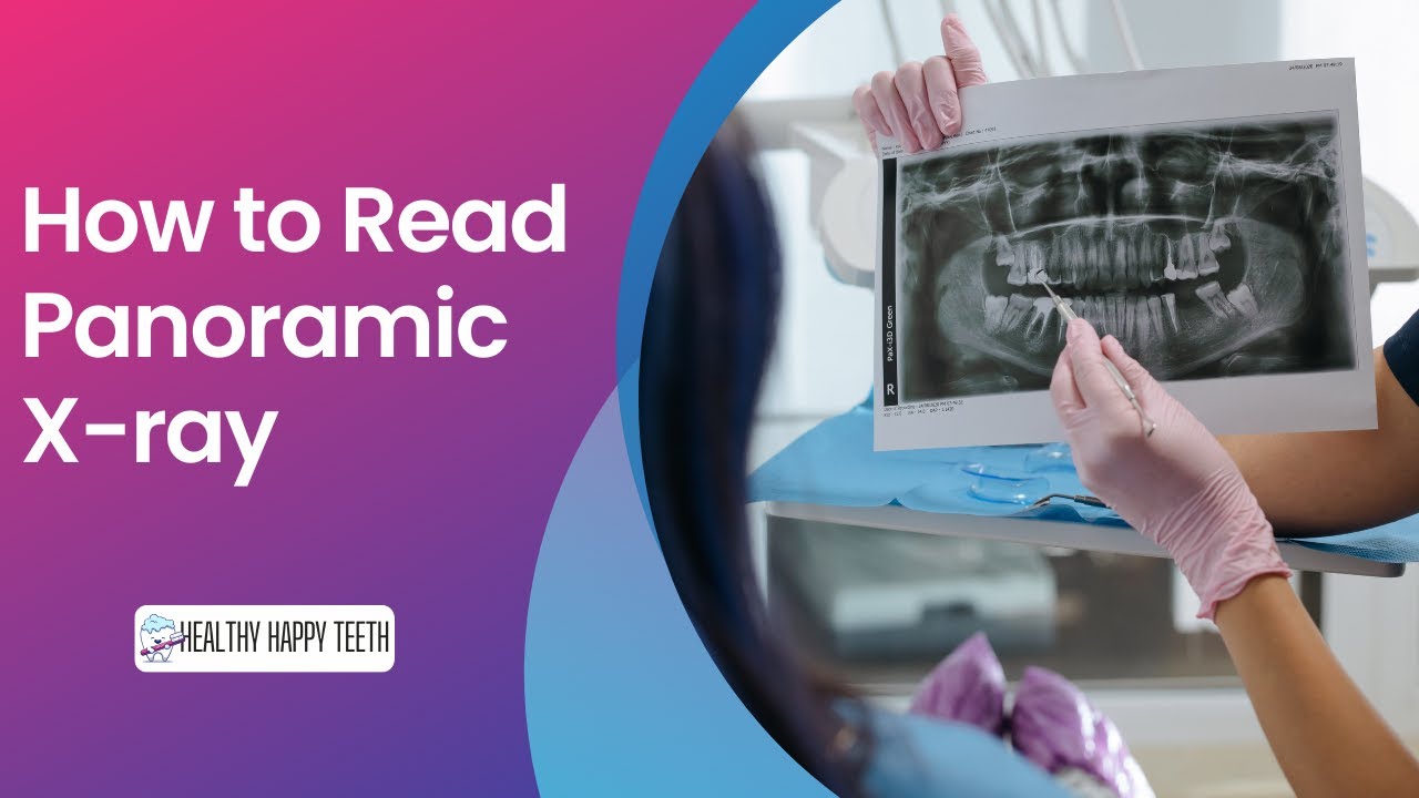 How to Read Dental Panoramic X-ray - YouTube