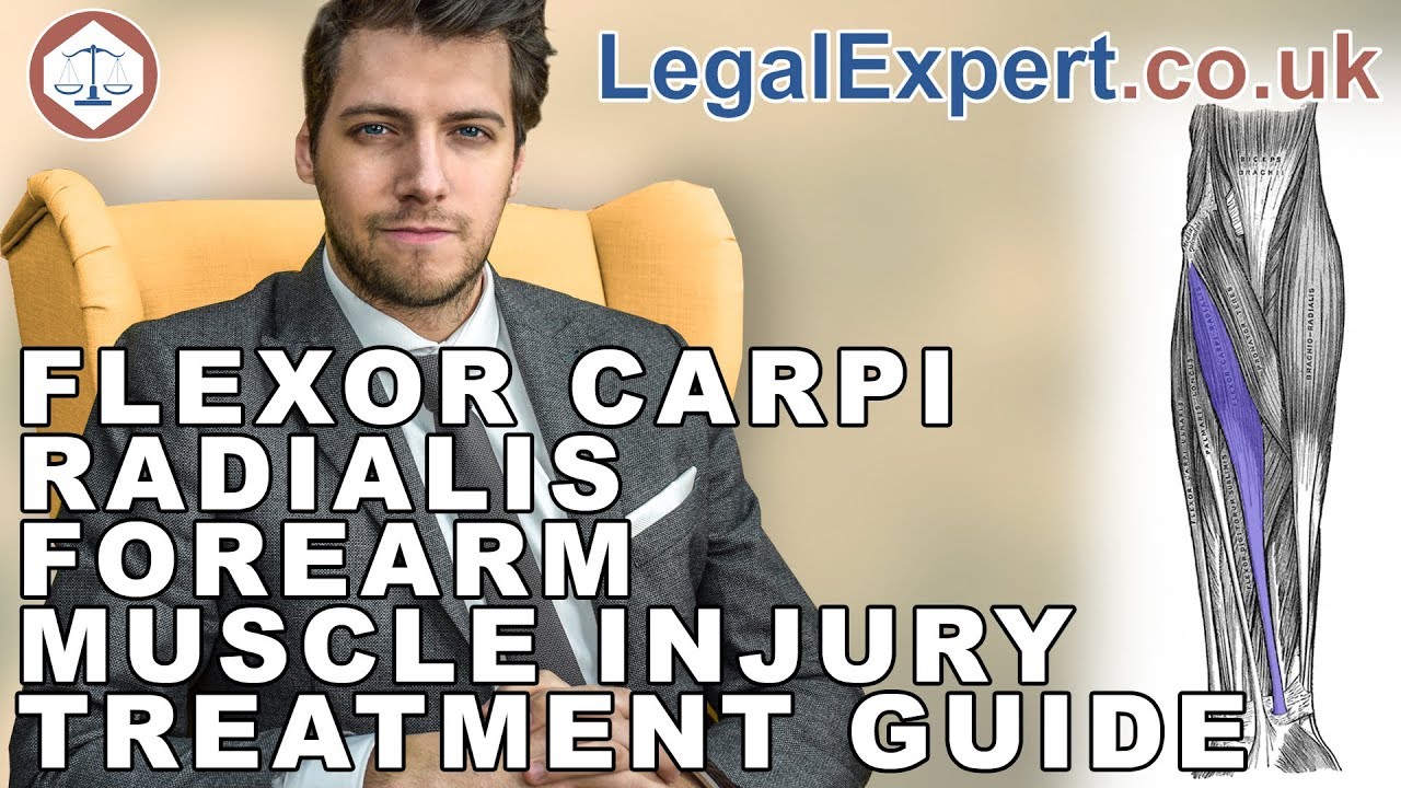 Flexor Carpi Radialis Forearm Muscle Injury Treatment Guide ( 2019 ) UK ...