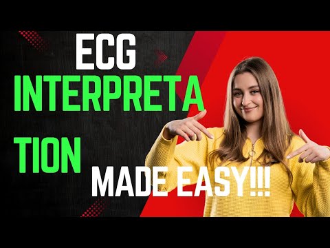ECG/EKG Interpretation//Basics of ECG intrepretation//Understanding ECG ...