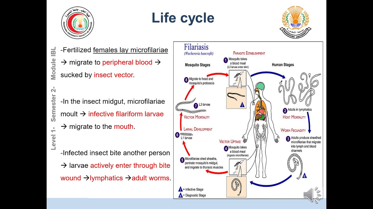 Parasitic infection of lymphatic system - YouTube