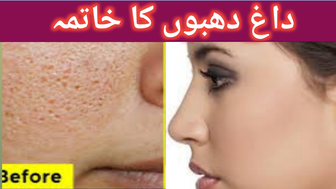 Best Night and Day Creams For Skin Lightening |Multani mitti sy dagh ...