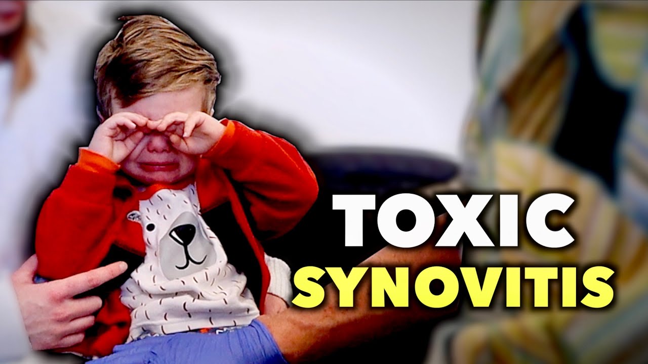 HE HAS TOXIC SYNOVITIS! (What to Know & How to Spot It in Kids) | Dr ...