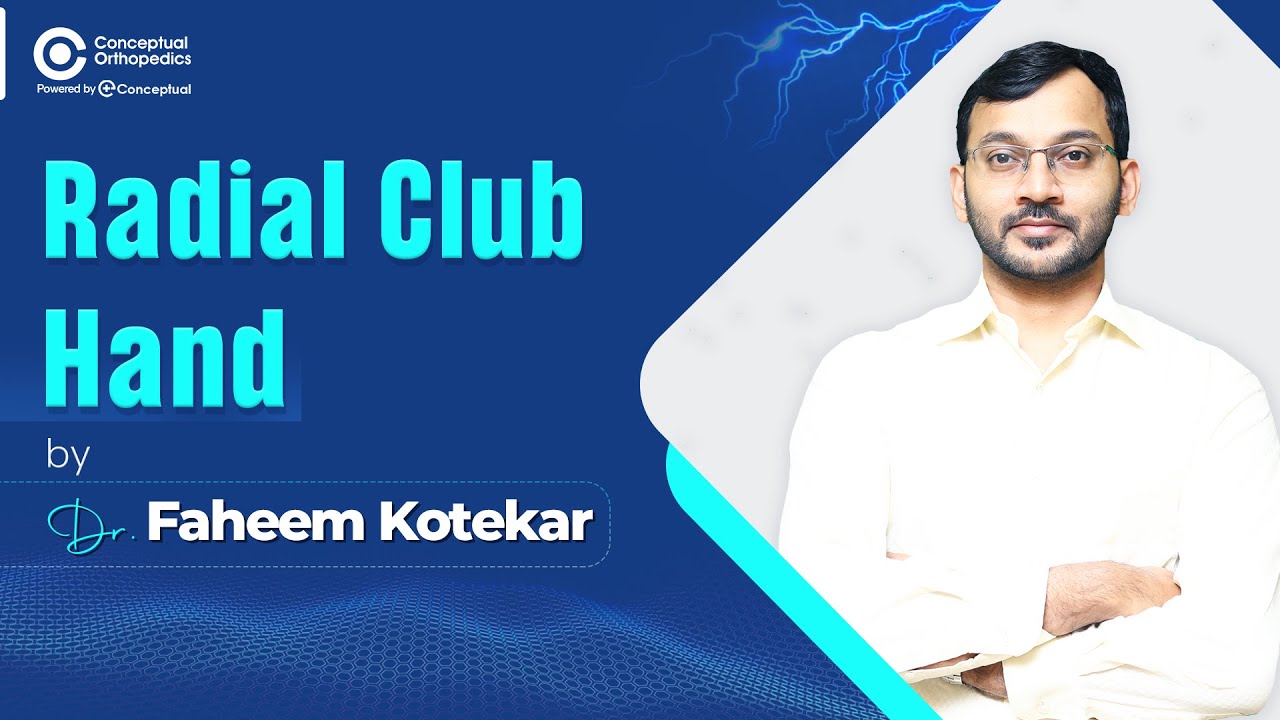 Radial Club Hand by Dr. Faheem Kotekar@ConceptualOrthopedics - YouTube