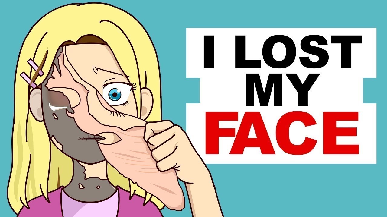 I Lost My Face - YouTube