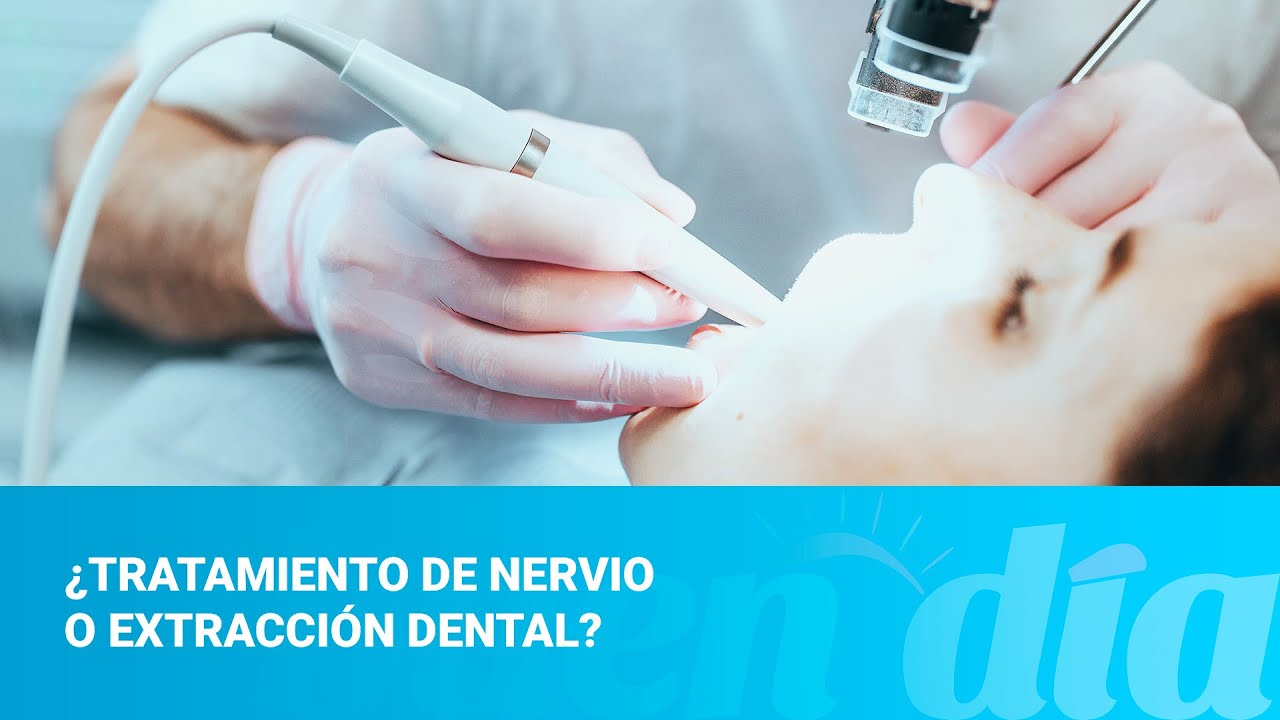 ¿Tratamiento de nervio o extracción dental? - YouTube
