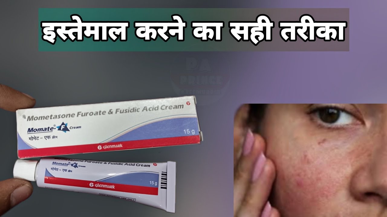 mometasone furoate and fusidic acid cream | momate f cream | momate f ...