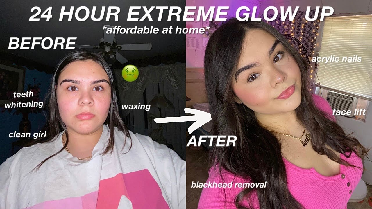 24 HOUR EXTREME GLOW UP TRANSFORMATION: nails, face lift, laser hair ...