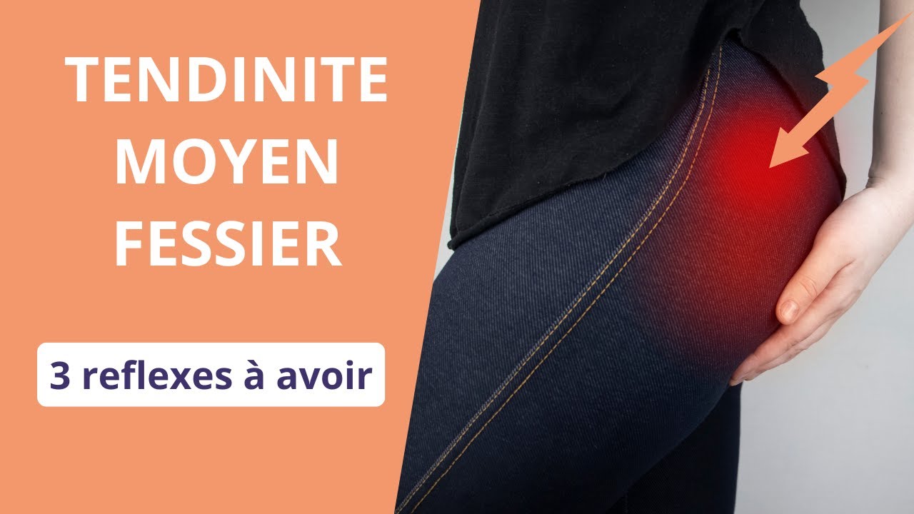 Tendinite du moyen fessier : exercices pour soulager la douleur ...
