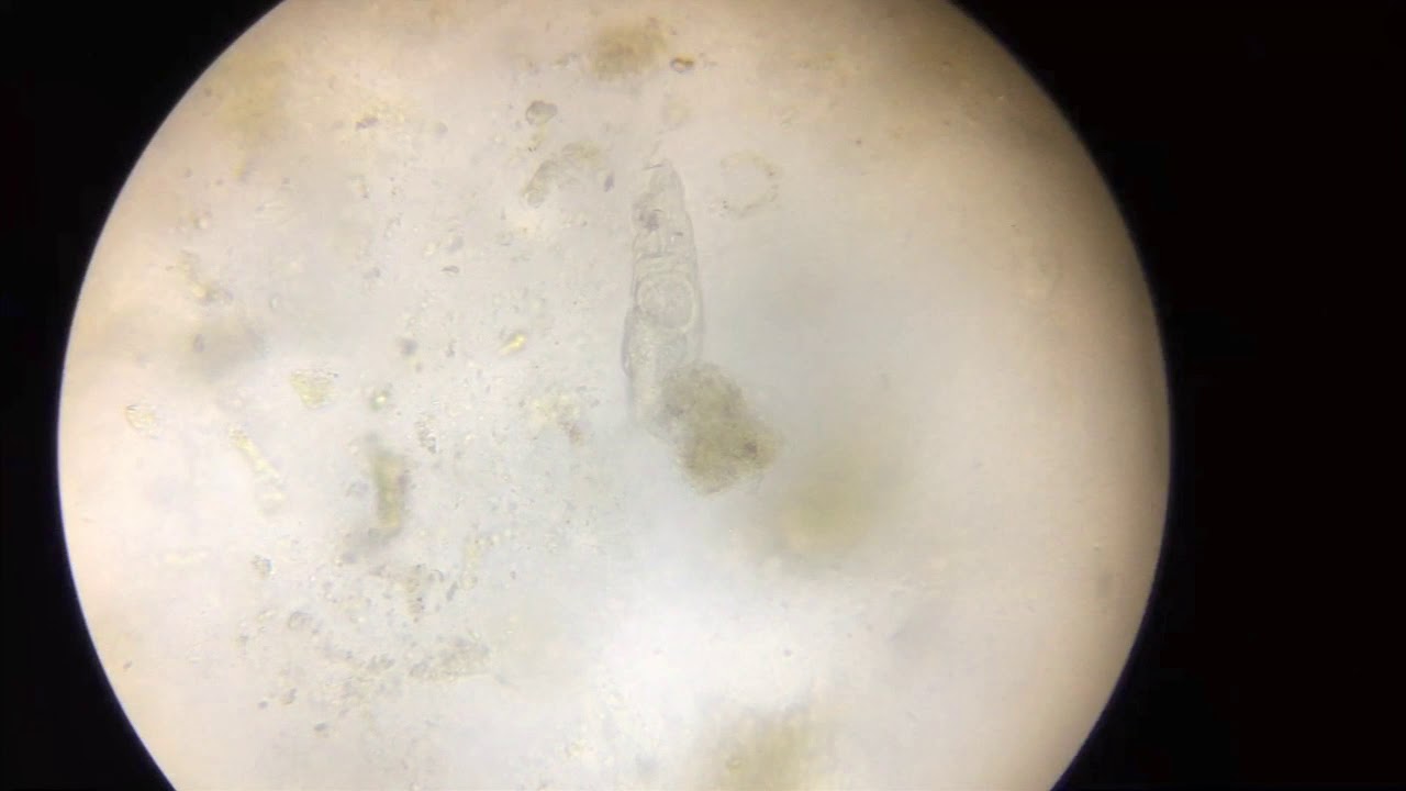 Rotifer and Detritus Worm under the microscope 400x - YouTube