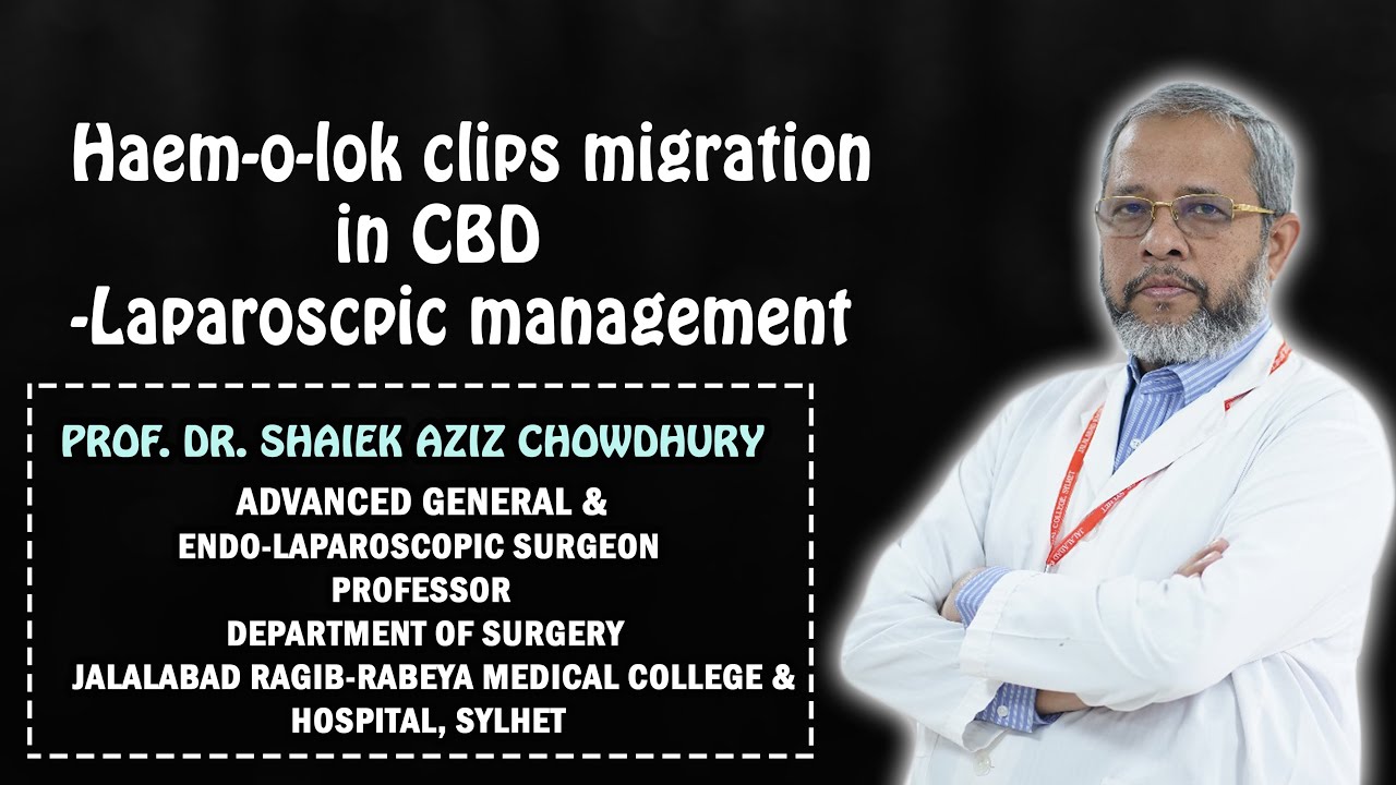 Hem-o-lok clips migration in CBD- Laparoscopic management. - YouTube