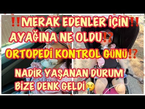 ❌MERAK EDENLER İÇİN ❌AYAĞINA NE OLDU⁉️NADİR YAŞANAN DURUM BİZE DENK GELDİ🥺ORTOPEDİ KONTROL GÜNÜ⁉️