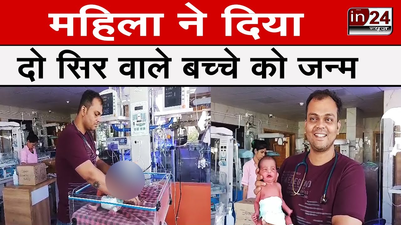 Two children have one body but two heads in Jalgaon | Special story ...