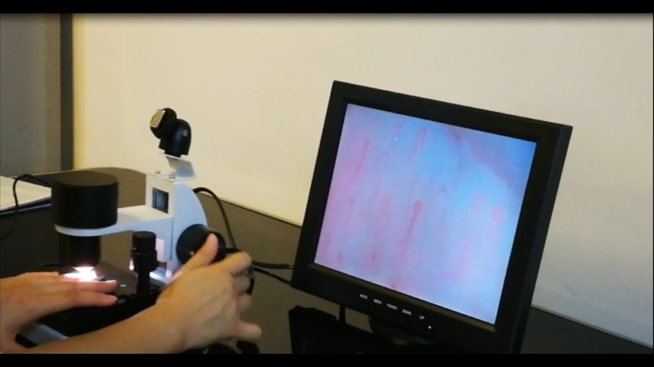 microcirculation microscope machine operation and test video - YouTube