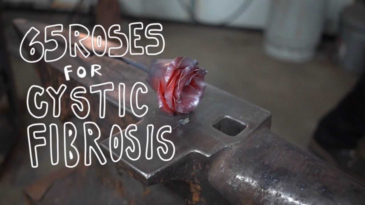 65 Roses for Cystic Fibrosis - YouTube