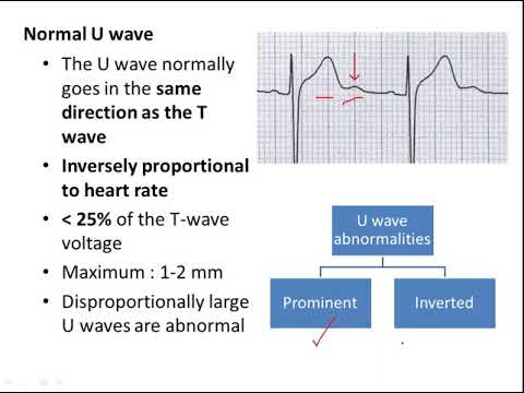 Inverted U wave - YouTube