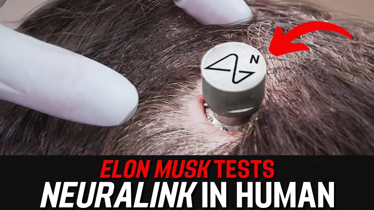 Elon Musk Tests Neuralink In Human Study - YouTube