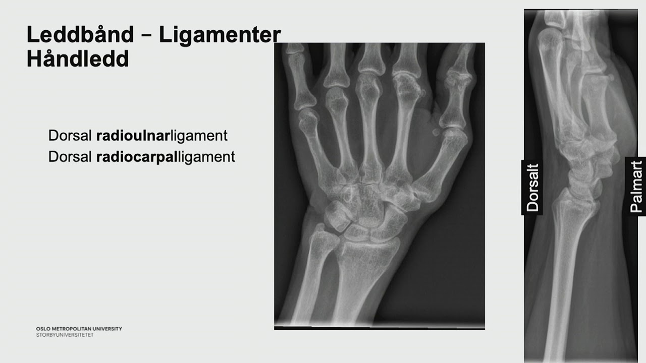 Leddbånd og sener i håndledd og hånd - YouTube