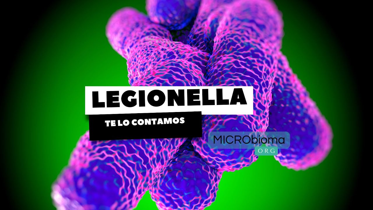 Legionella