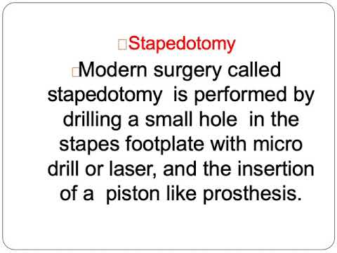 otosclerosis and functional aphonia - YouTube