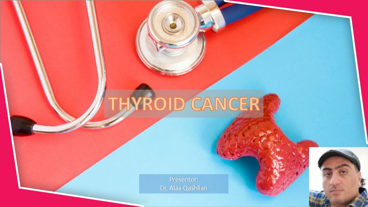 Thyroid cancer simplified for patients - YouTube