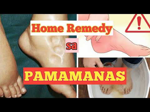 MGA HALAMANG GAMOT PARA SA PAMAMANAS - YouTube