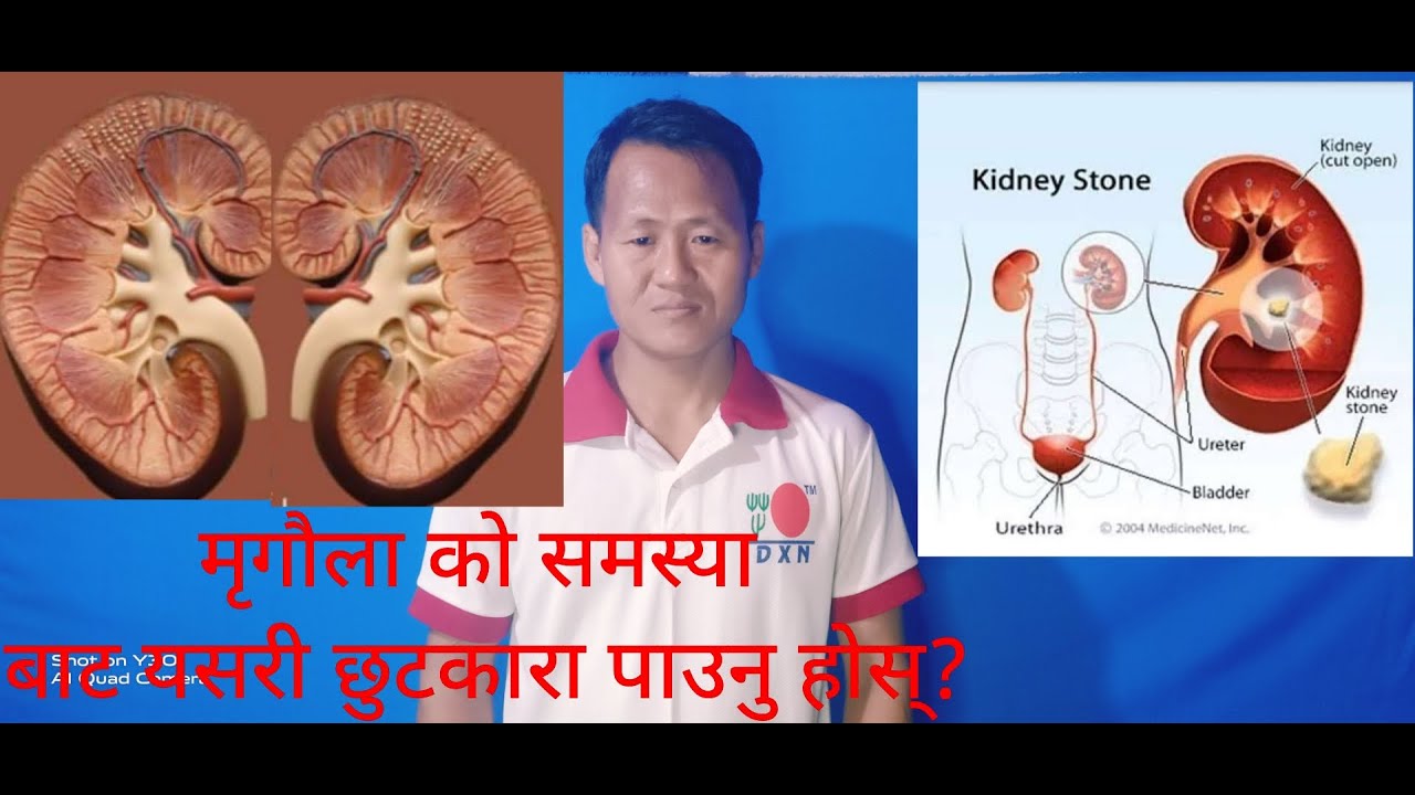 मृगौला को समस्या आउने कारण, लक्ष्यण अनी गानो थेरापी बाट कसरी उपचार गर्न ...