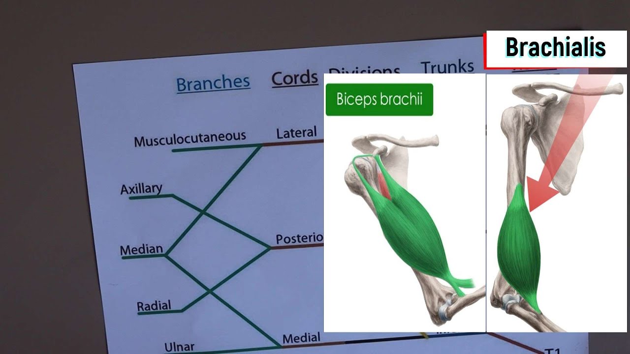 Pleksus Brachialis (klinik nöroanatomi) - YouTube
