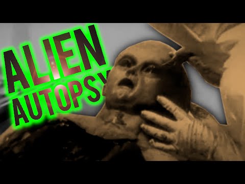 The Alien Autopsy: An Elaborate Hoax
