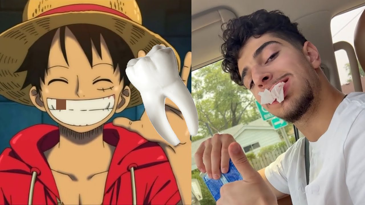 POST WISDOM TEETH EXTRACTION (FUNNY)😂😂 - YouTube