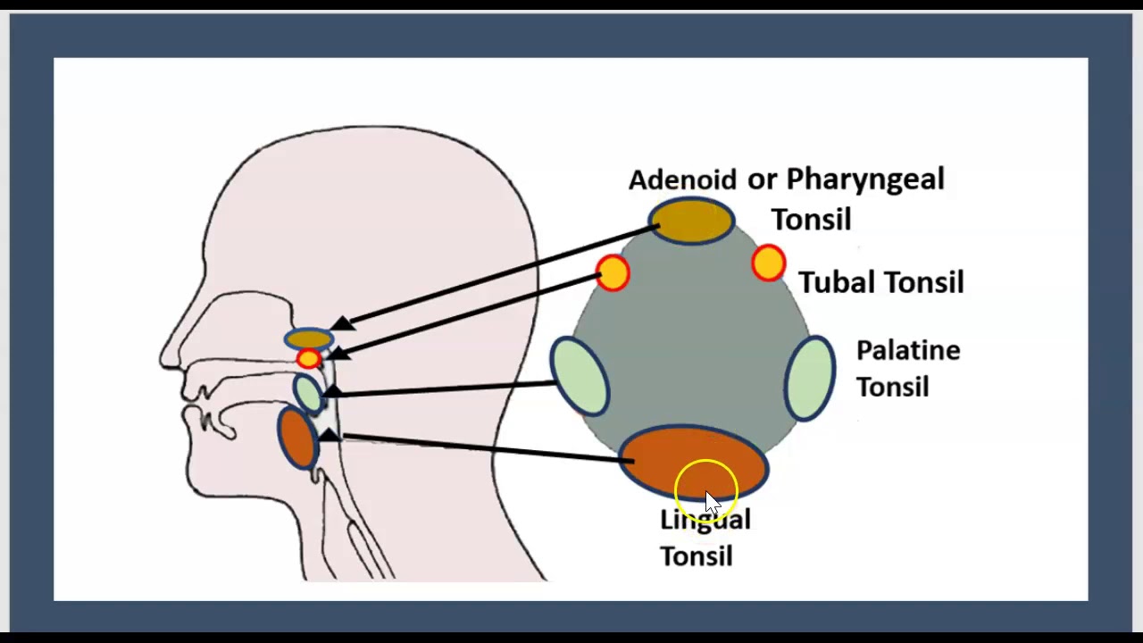 Medicine Minute: 3 Traiter les végétations adénoïdes Amygdales Palatine ...