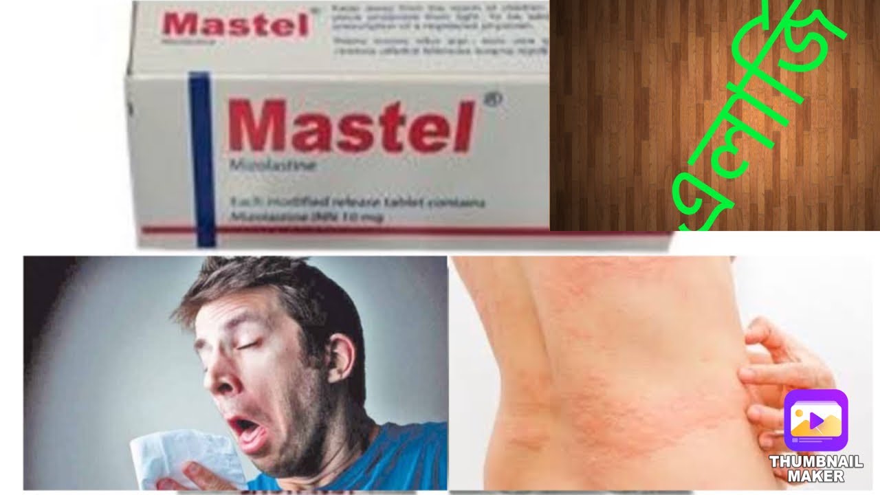 mastel tablet review bangla. এলার্জি ঔষধ এর নাম। এলার্জি ঔষধ এর নাম ...